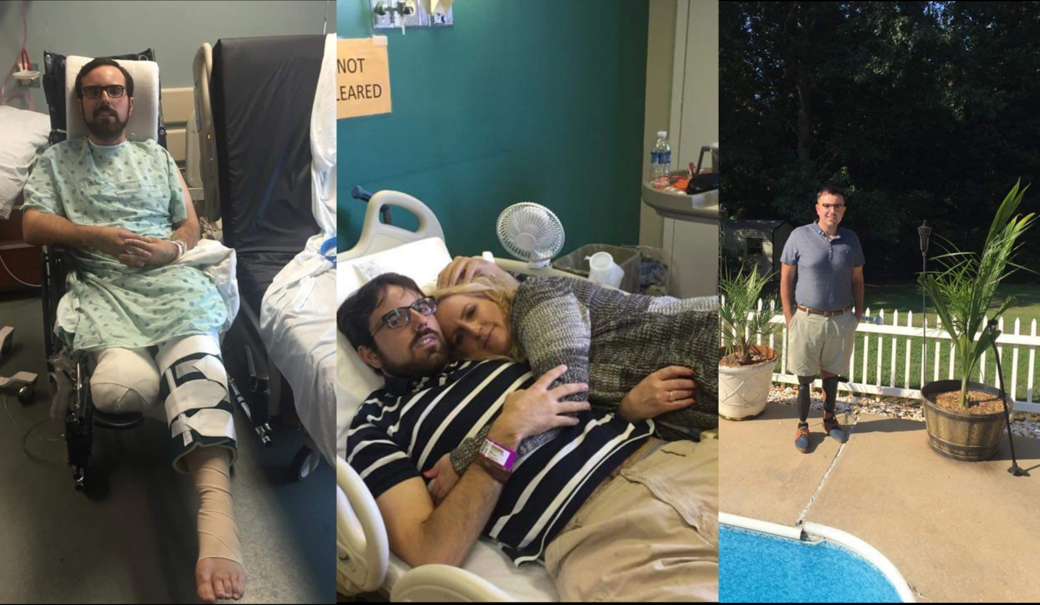 Meet Chris Rains, a Symbol of Triumph - Amputee Athletes - Click Medical